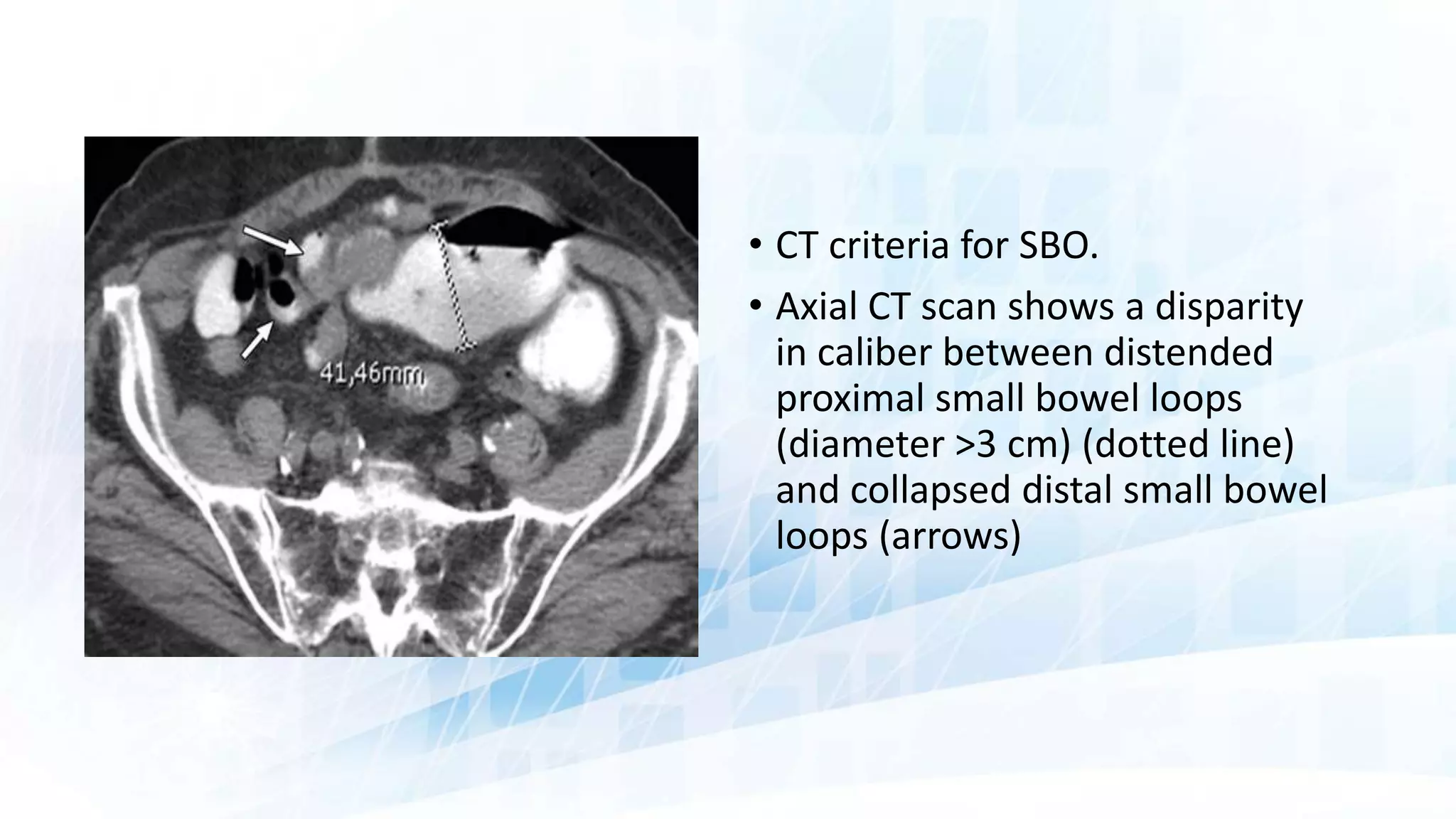 RADIOLOGIC ANATOMY OF SMALL INTESTINE AND INTRODUCTION TO SMALL BOWEL ...