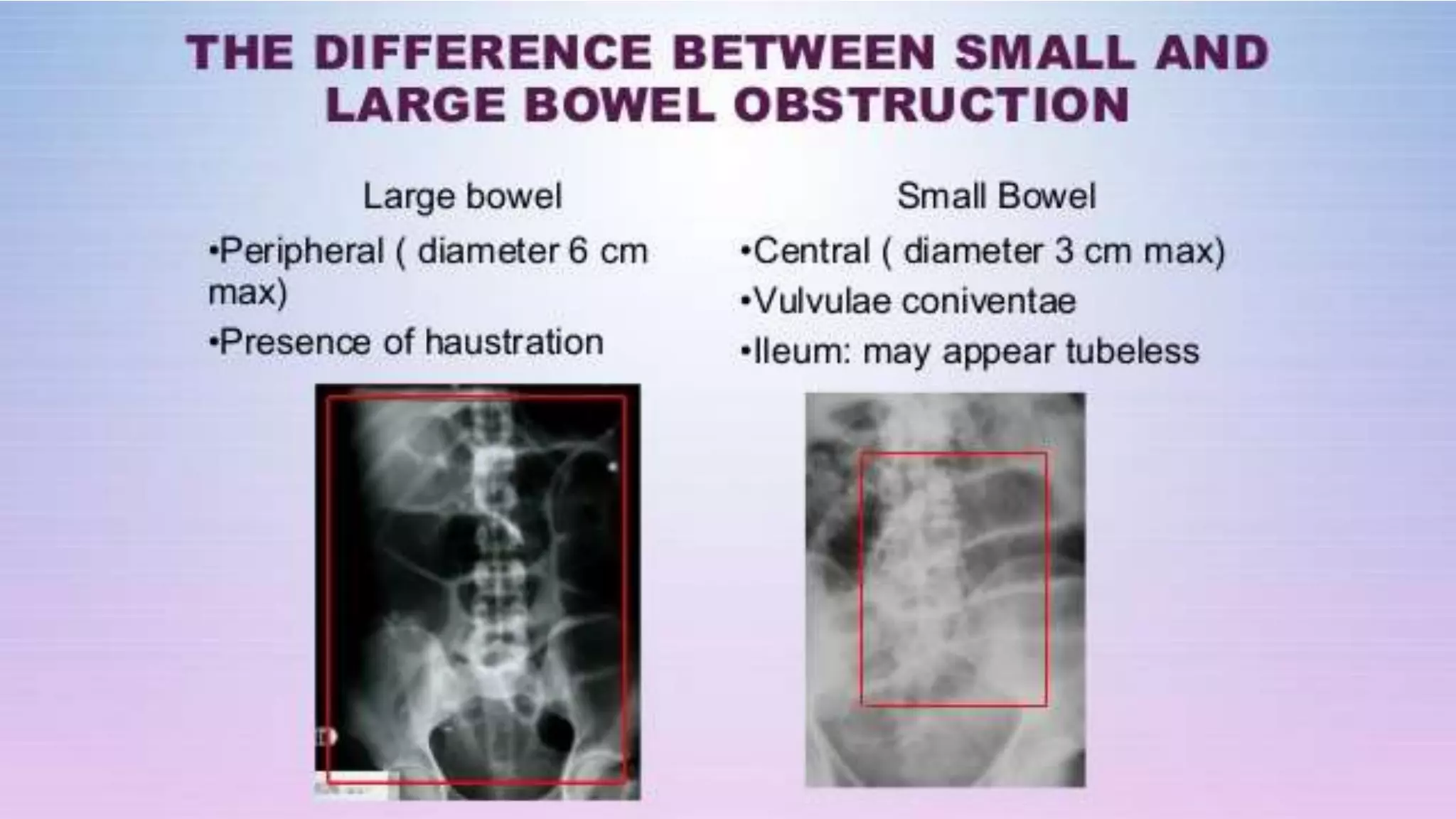 RADIOLOGIC ANATOMY OF SMALL INTESTINE AND INTRODUCTION TO SMALL BOWEL ...