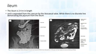 RADIOLOGIC ANATOMY OF SMALL INTESTINE AND INTRODUCTION TO SMALL BOWEL ...