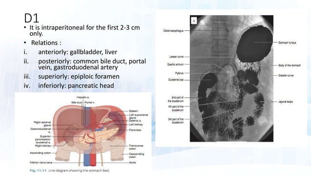 RADIOLOGIC ANATOMY OF SMALL INTESTINE AND INTRODUCTION TO SMALL BOWEL ...