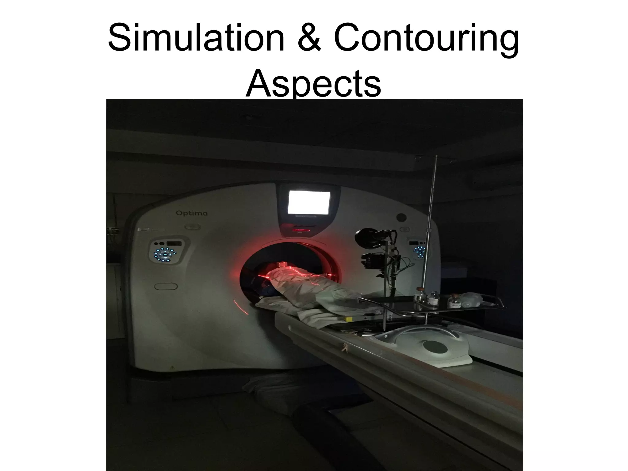 SBRT Contouring Guidelines | PPT