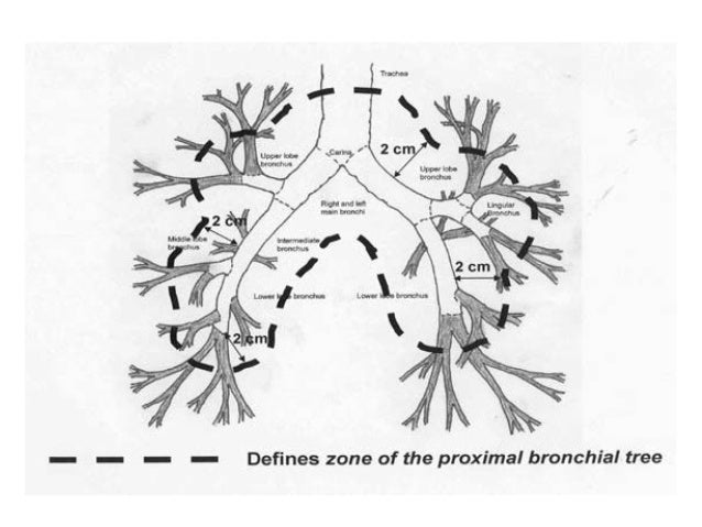 SBRT Contouring Guidelines