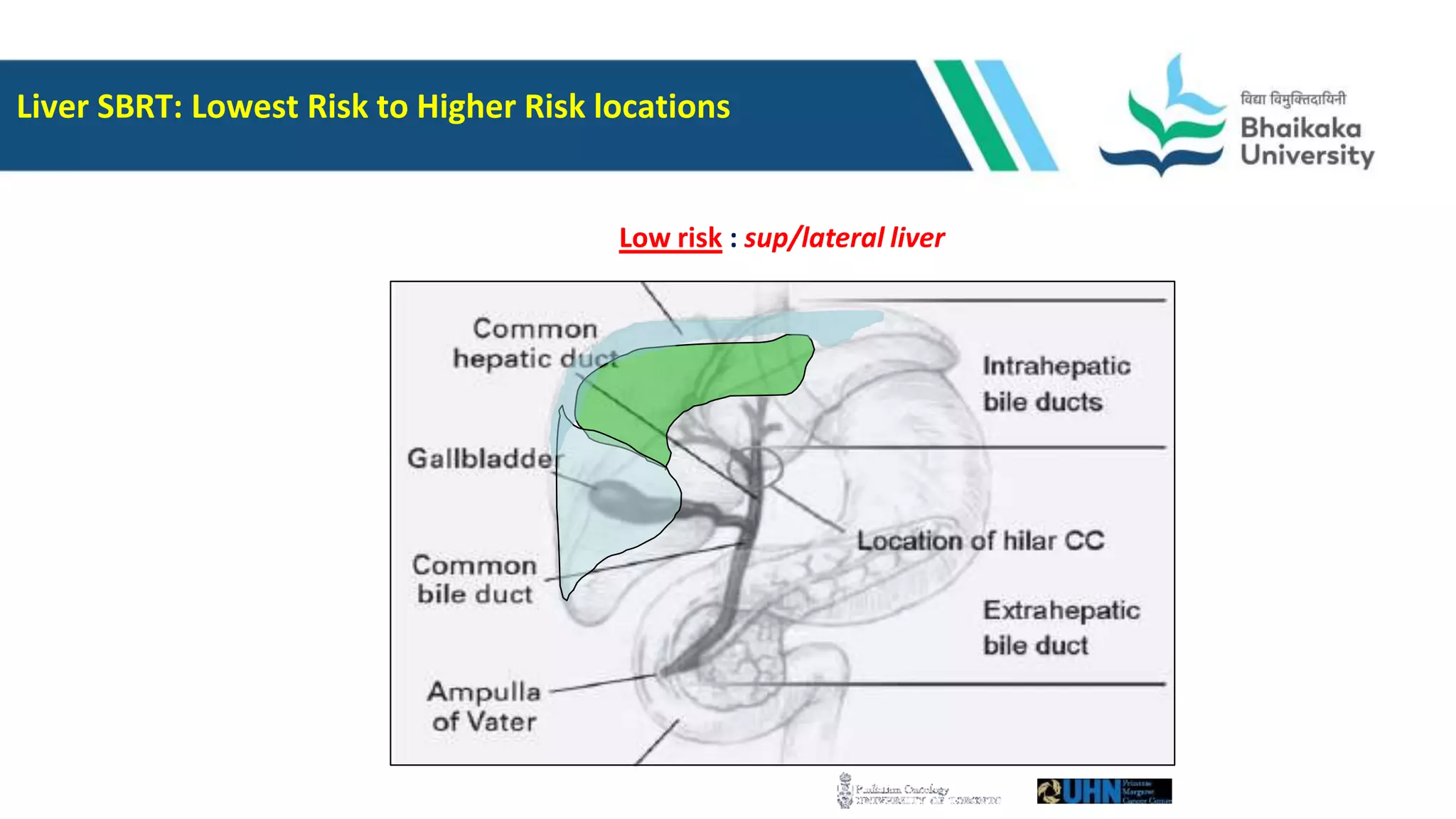 SBRT Liver when and how.pptx