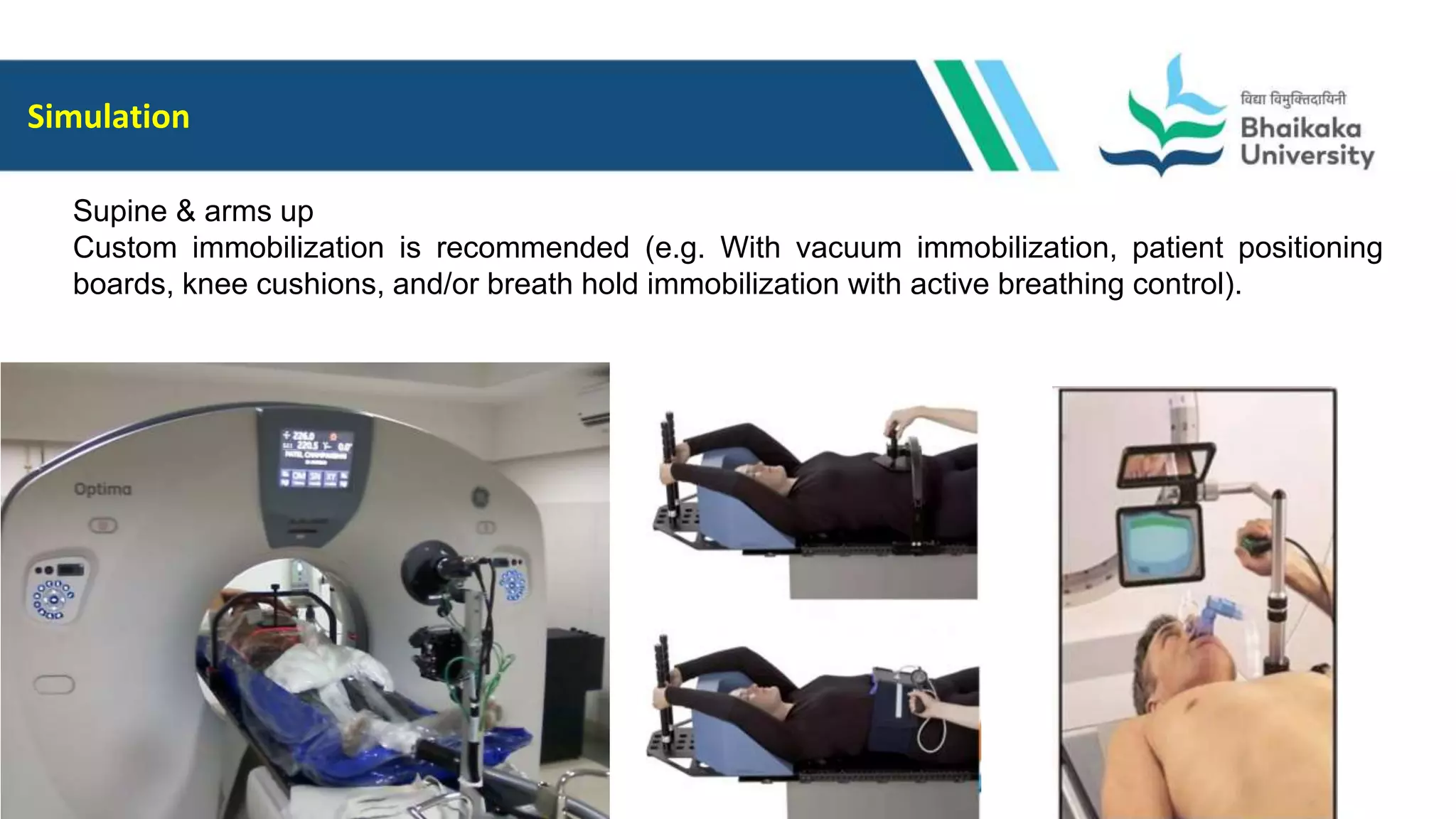 SBRT Liver when and how.pptx