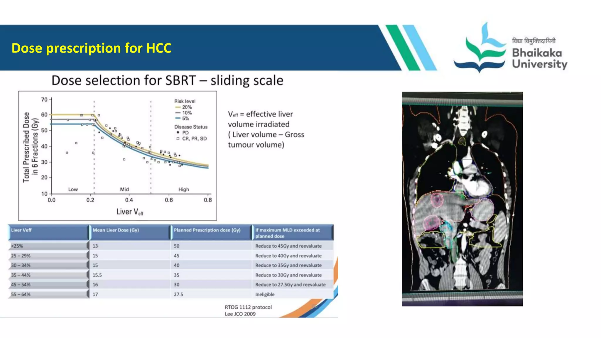 SBRT Liver when and how.pptx