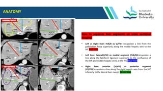 SBRT Liver when and how.pptx