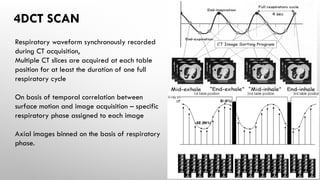 SBRT (Stereotactic Body Radiation Therapy in Lung Cancer.pptx