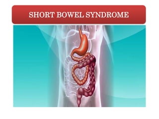 SHORT BOWEL SYNDROME | PPTX | Digestive Disorders | Diseases and Conditions