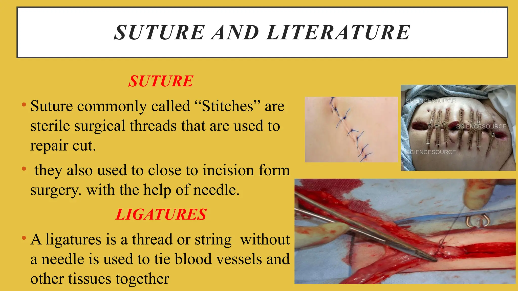 Sutures and ligatures. pptx | PPTX