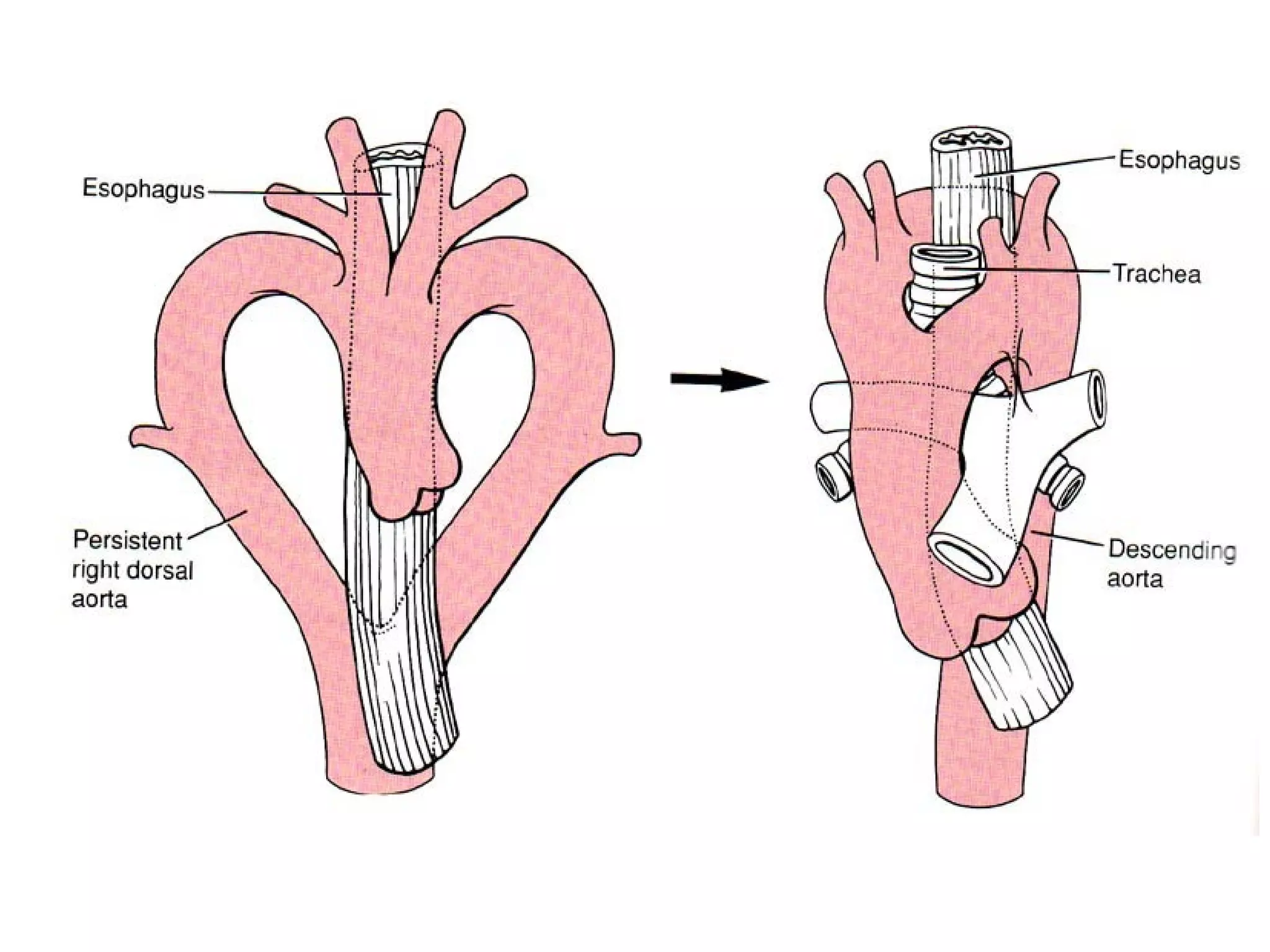 Development of arterial and venous system | PPT