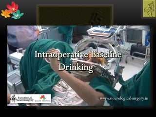 SCA 12| DBS Surgery| Neurological Surgery| Dr Paresh Doshi | PPT