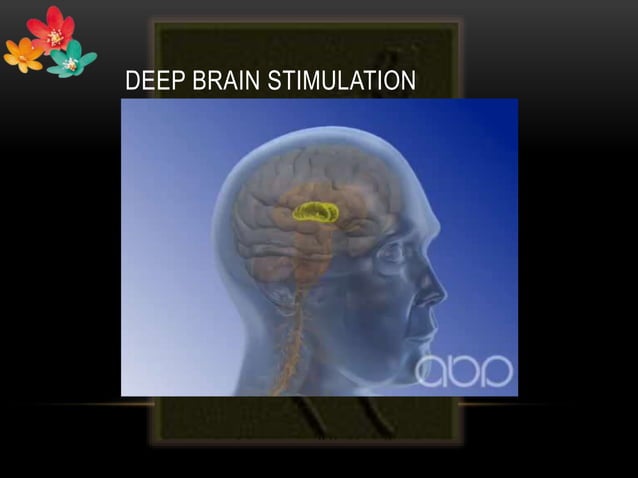 SCA 12| DBS Surgery| Neurological Surgery| Dr Paresh Doshi | PPTX