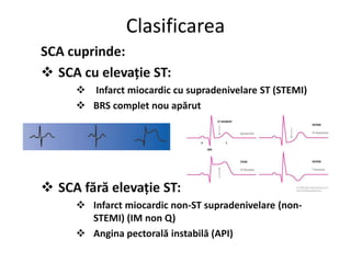 Sindrom Coronarian Acut | PPTX