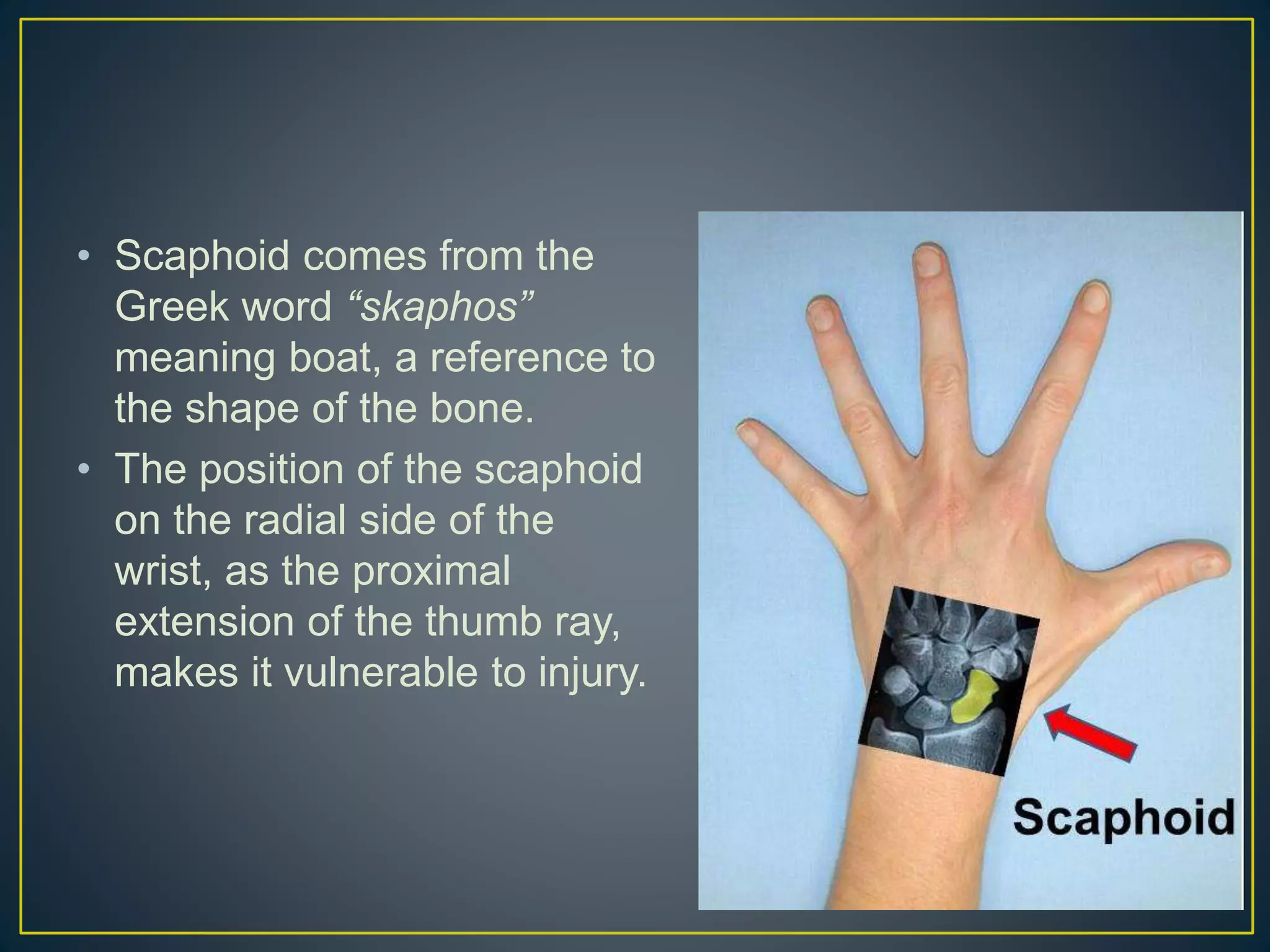 ScaPHOID # | PPT