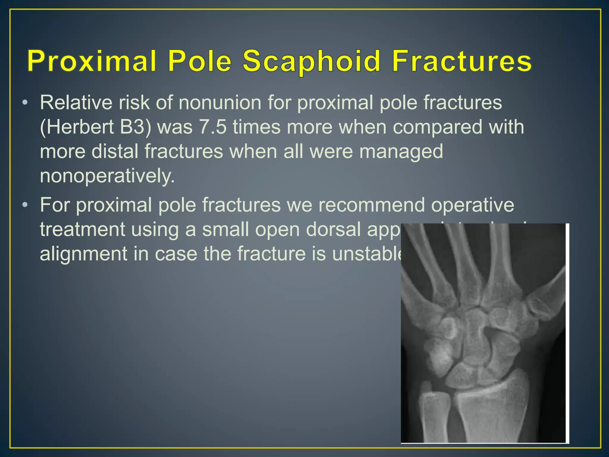 ScaPHOID # | PPT