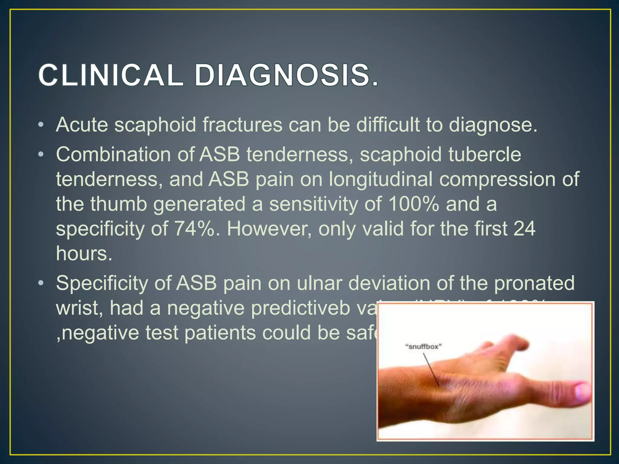 ScaPHOID # | PPT