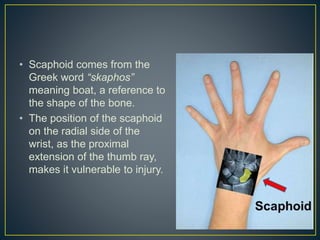 ScaPHOID # | PPT