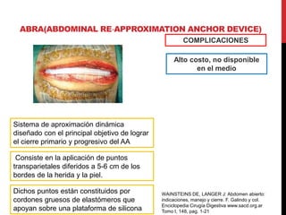 Síndrome compartiméntal abdominal | PPTX