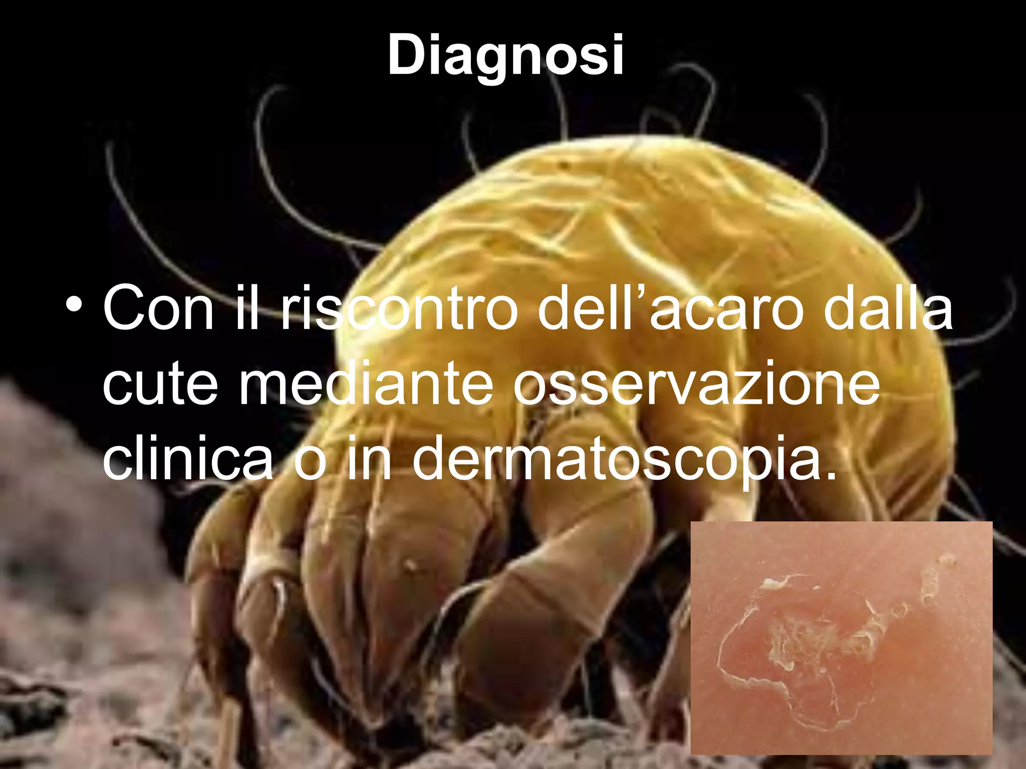 Scabbia e hpv valeria fontanella | PPT