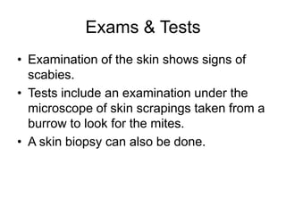Scabies | PPT