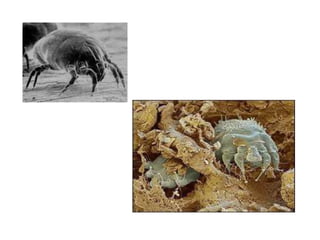 Scabies | PPTX