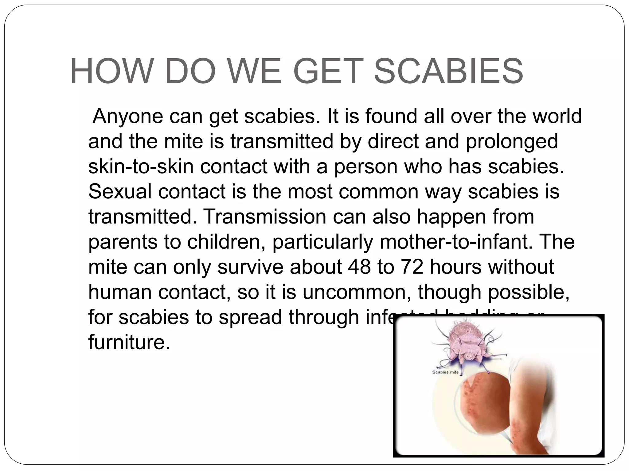 Scabies | PPTX