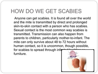 Scabies | PPTX