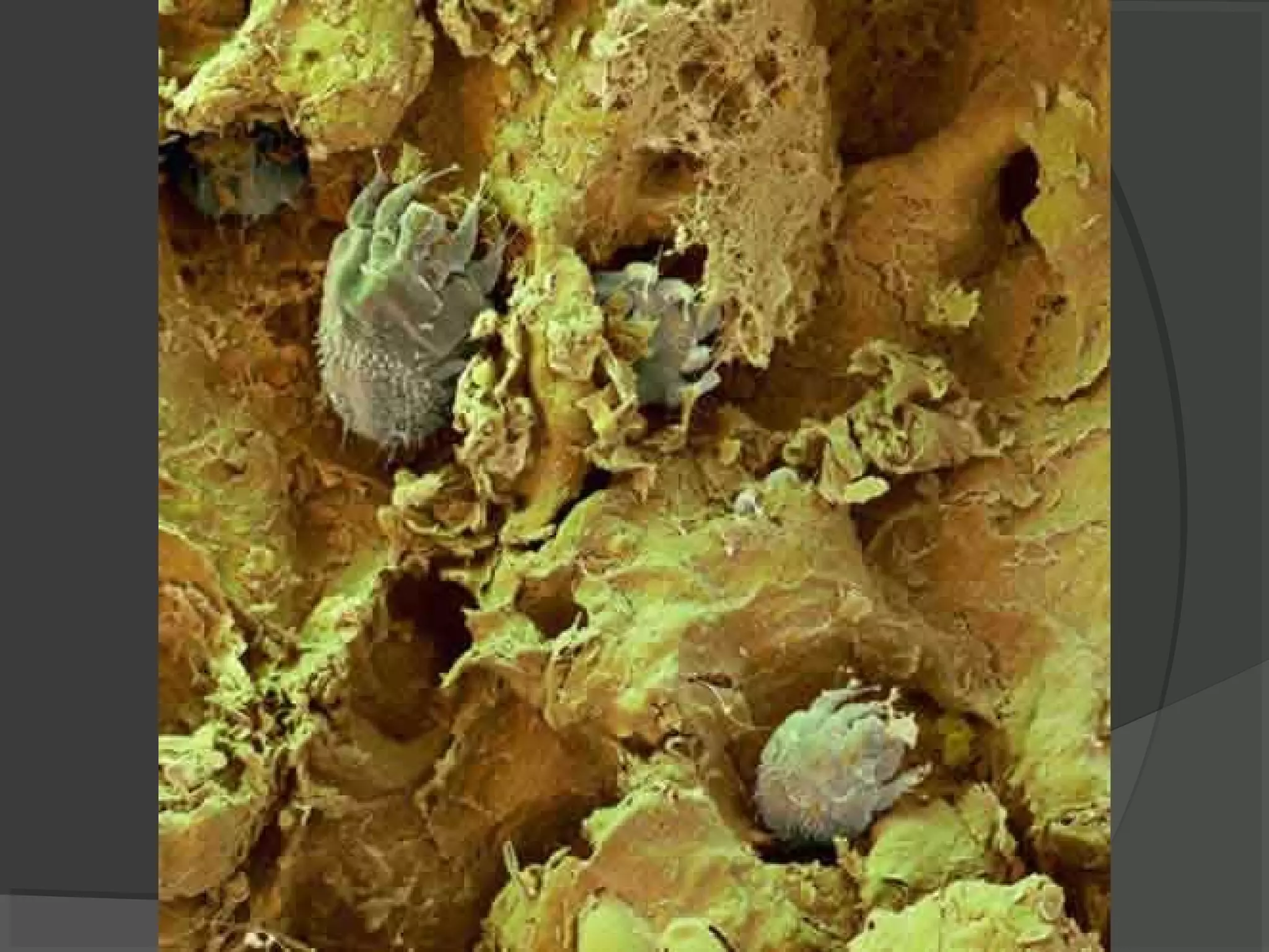 Scabies | PPT | Infectious Diseases | Diseases and Conditions