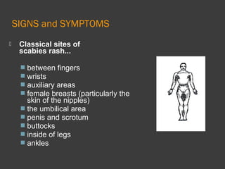 Scabies | PPT