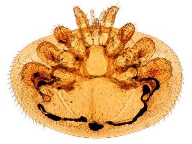 Scabies | PPT | Infectious Diseases | Diseases and Conditions