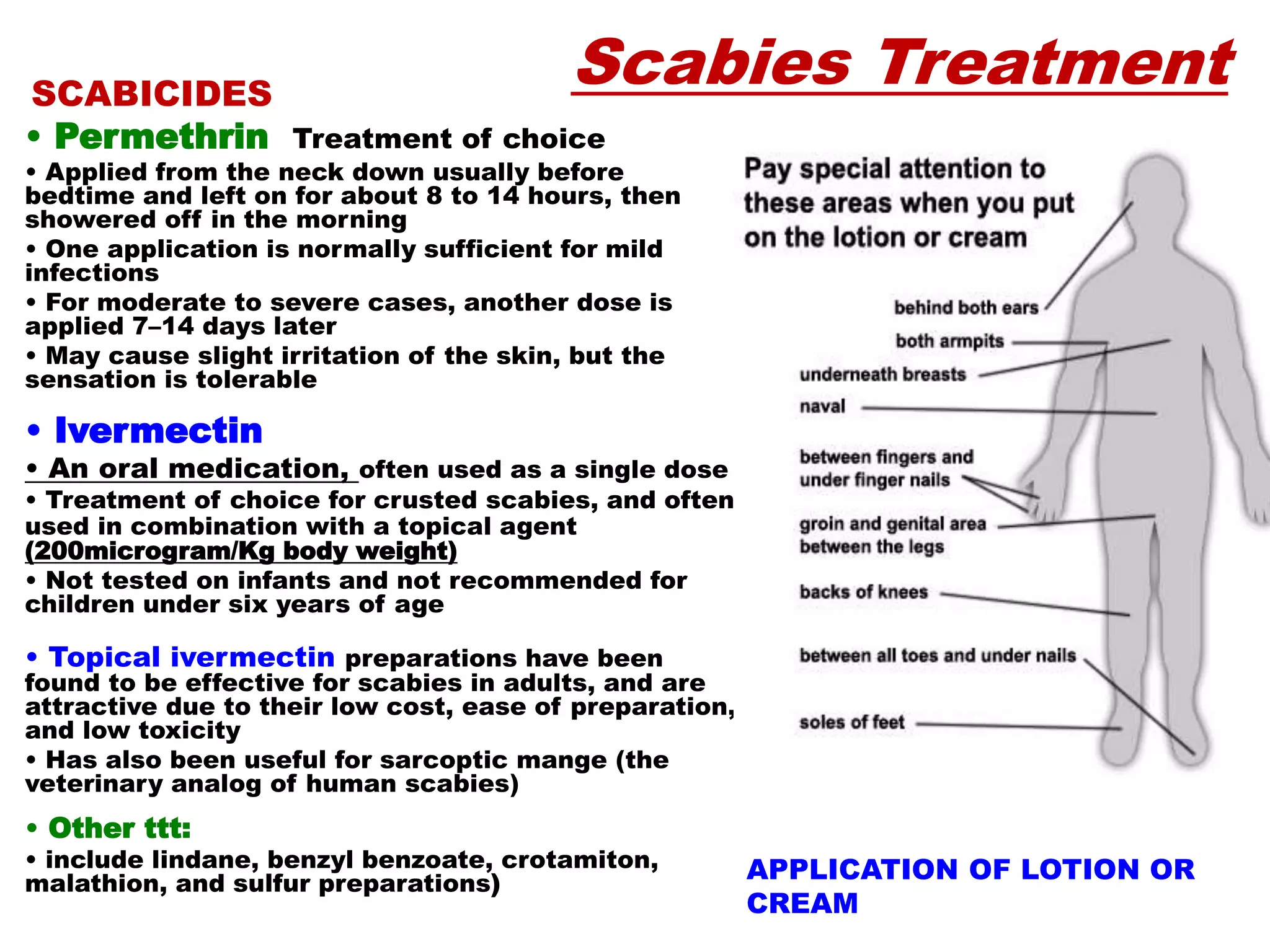 Scabies | PPTX