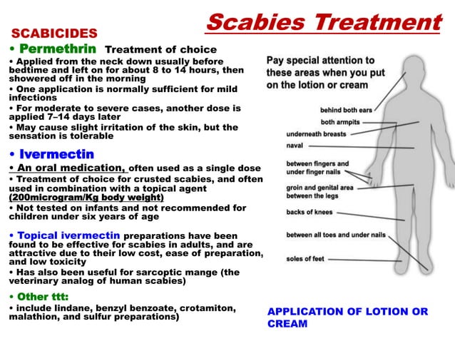 Scabies | PPTX | Skin and Dermatology | Diseases and Conditions