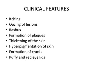 Scabies | PPTX