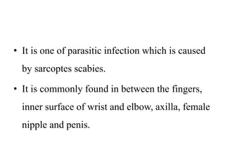 Scabies | PPTX | Skin and Dermatology | Diseases and Conditions
