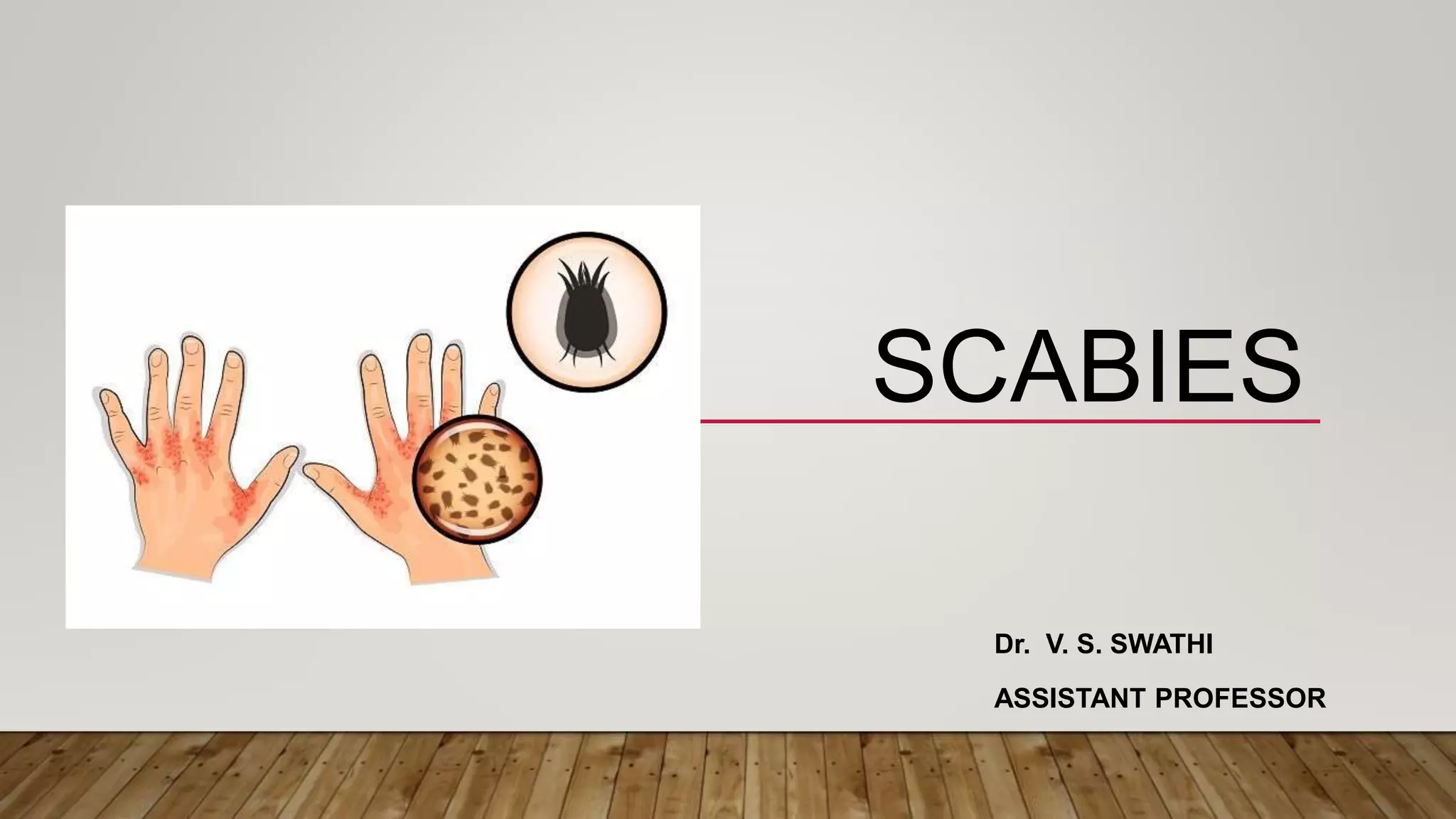 Scabies | PPTX