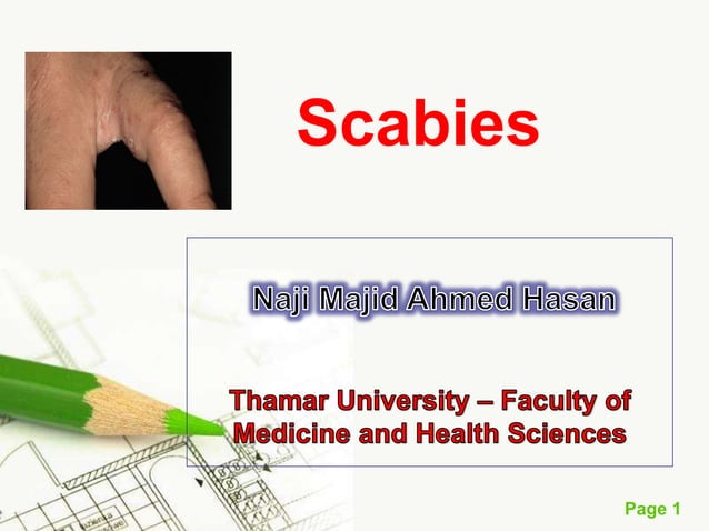 Scabies | PPT | Infectious Diseases | Diseases and Conditions