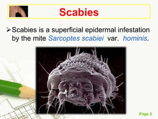 Scabies | PPT