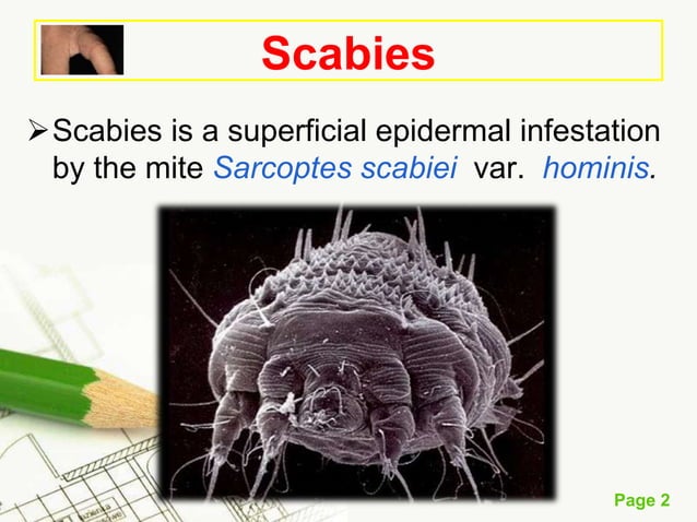 Scabies | PPT | Infectious Diseases | Diseases and Conditions