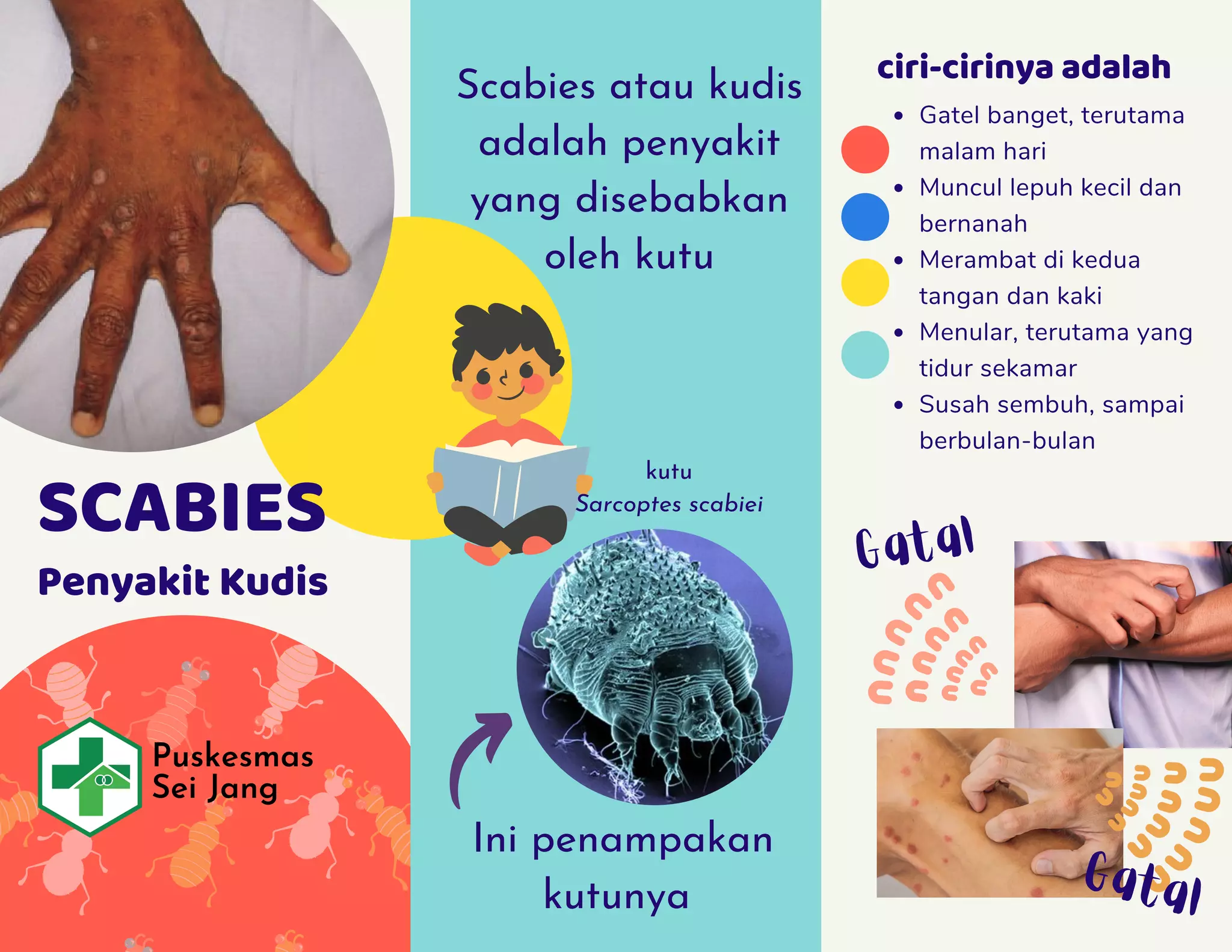 scabies.pdf