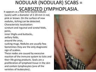 SCABIES | PPTX