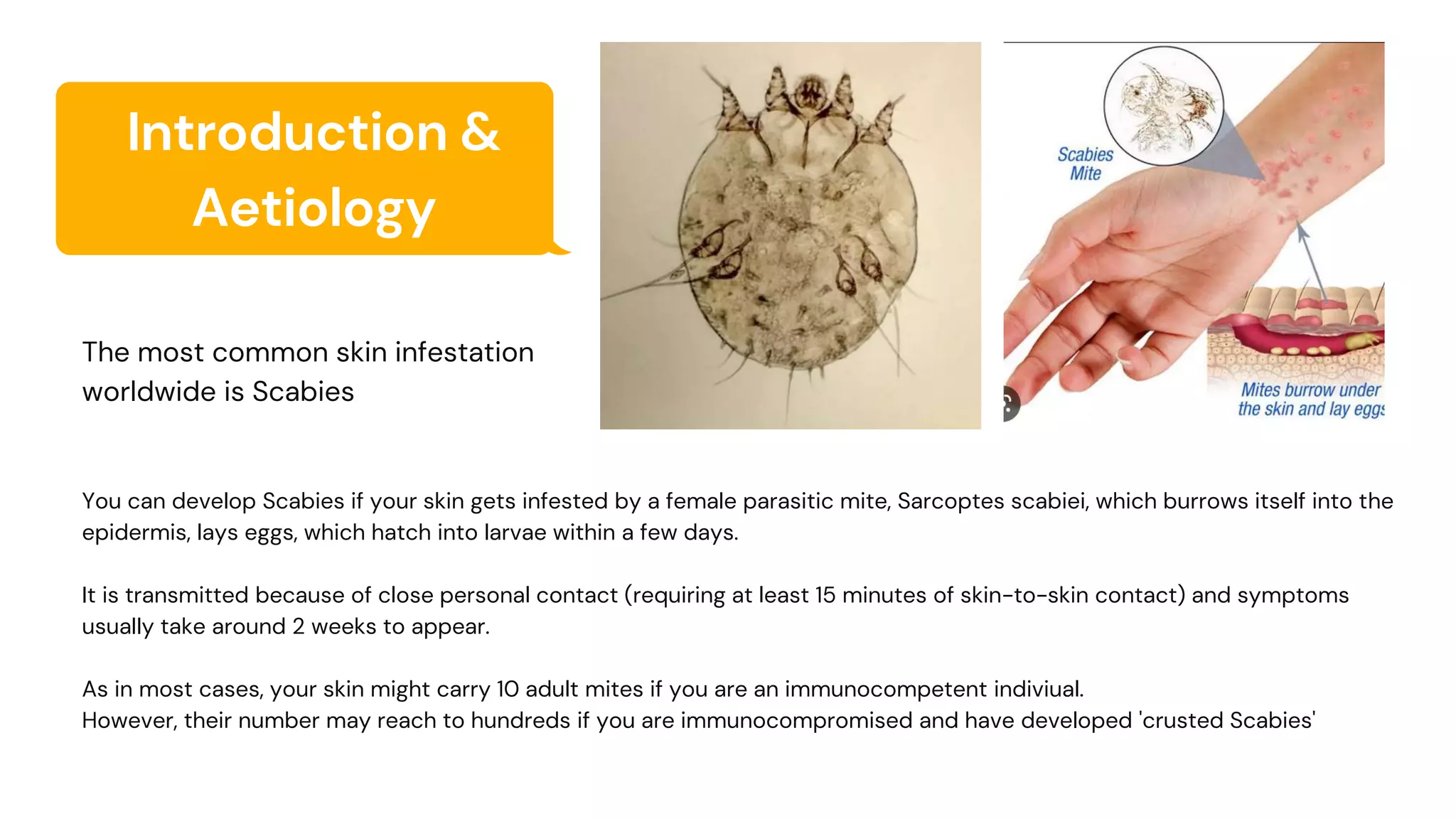 Scabies | PPT