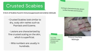 Scabies | PPT