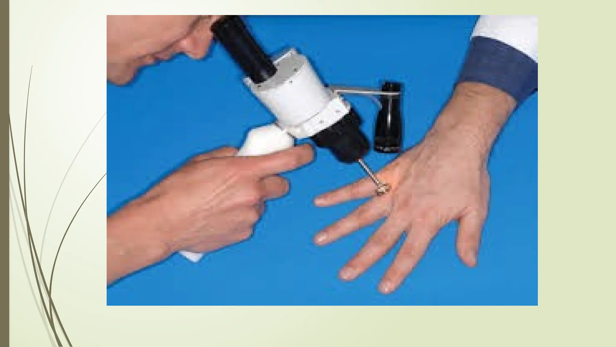 SCABIES as skin disease in adults and children | PPTX