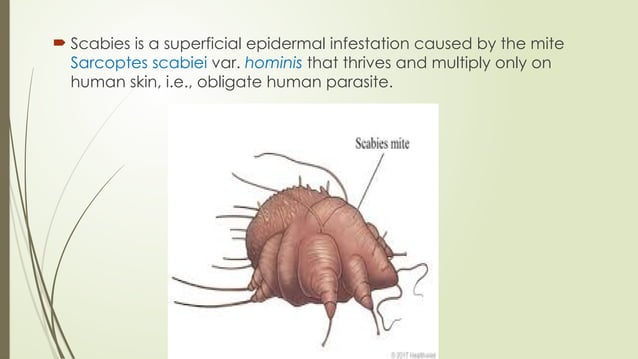 SCABIES as skin disease in adults and children | PPTX