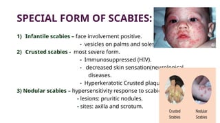scabies essay summarized Dermatology.pptx