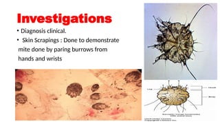 Dermatology presentation on scabies it's manifestation and management ...