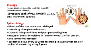 Dermatology presentation on scabies it's manifestation and management ...