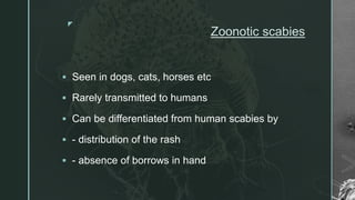 Scabies | PPTX