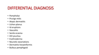 Scabies and pediculosis | PPTX