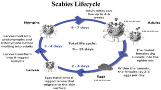 SCABIES BY DR MALZ.pptx